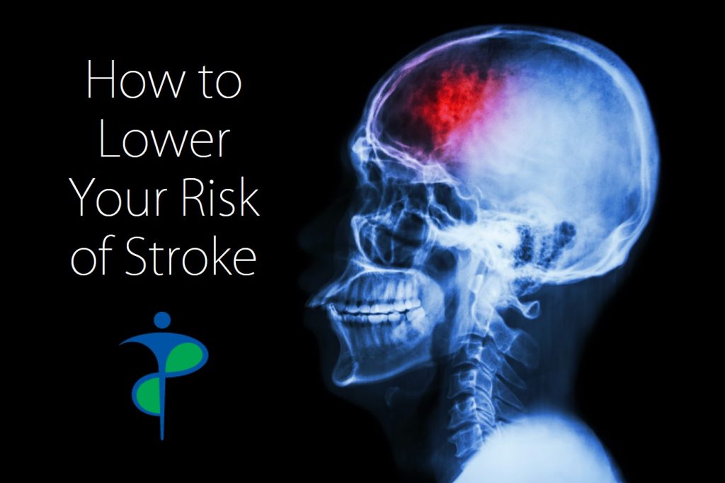 How to Lower Your Risk of Stroke: Recognize the Signs of a Stroke